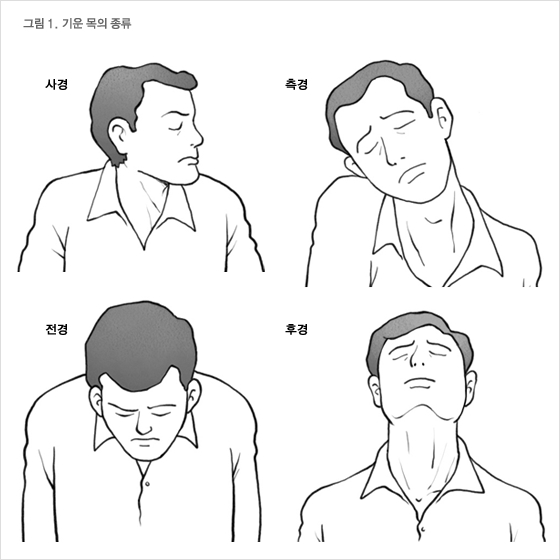 사경의 진단과 치료