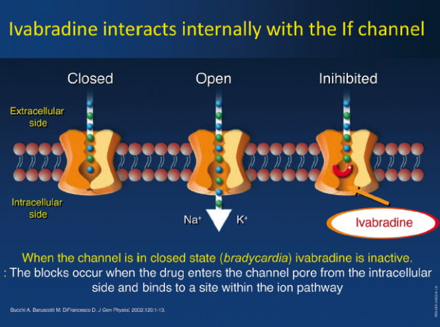 효과적인 심부전 치료를 위한 전략: Ivabradine