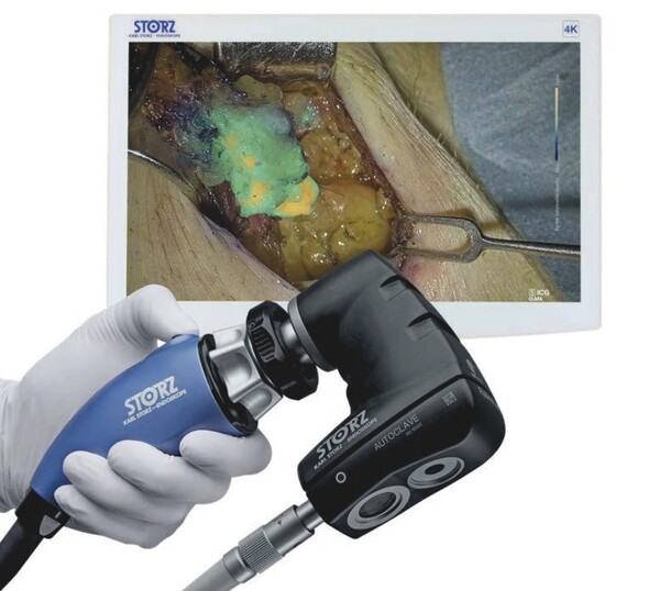 칼스톨츠, 4K ICG 엑소스코프 ‘Rubina Lens’ 출시